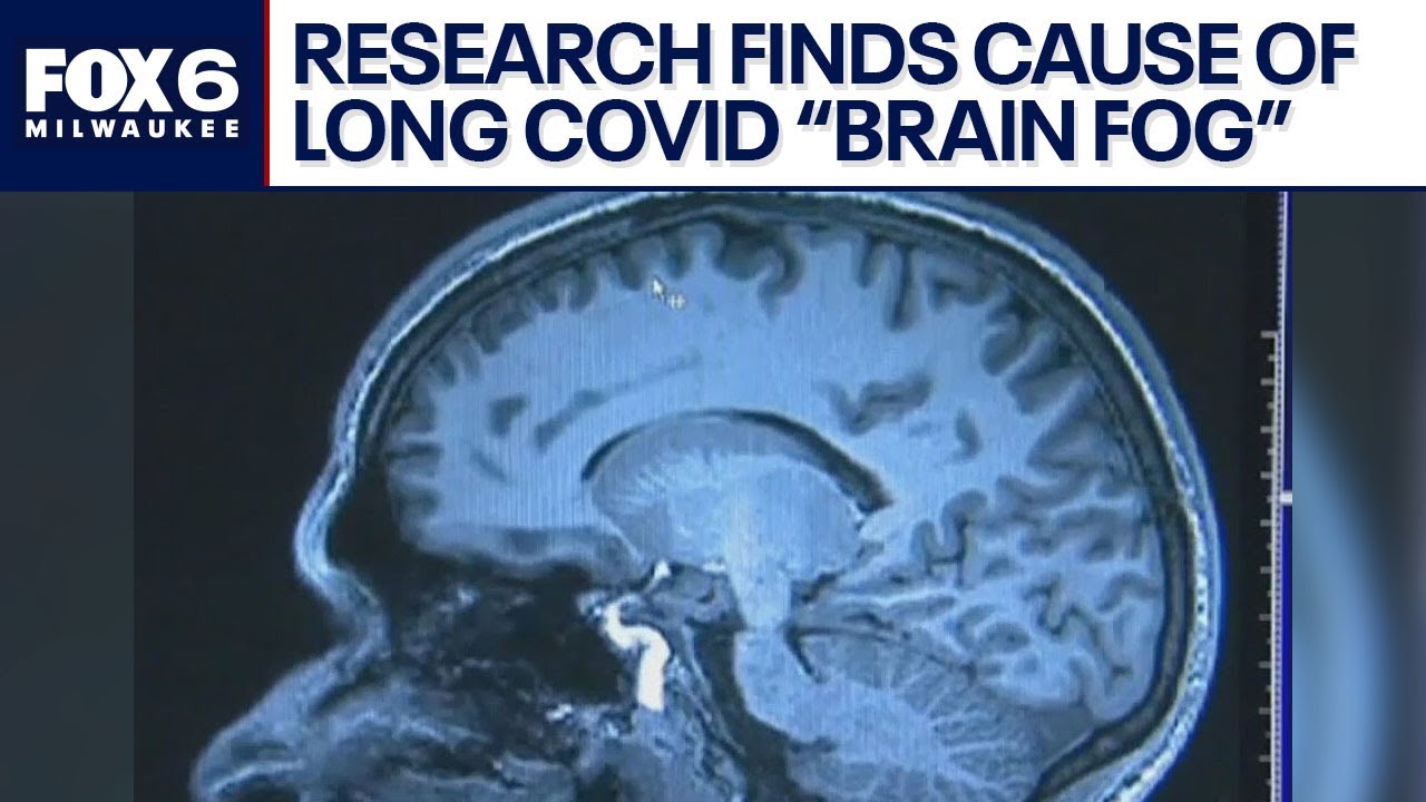 Long COVID 'brain fog,' doctor discusses research that identified cause ...