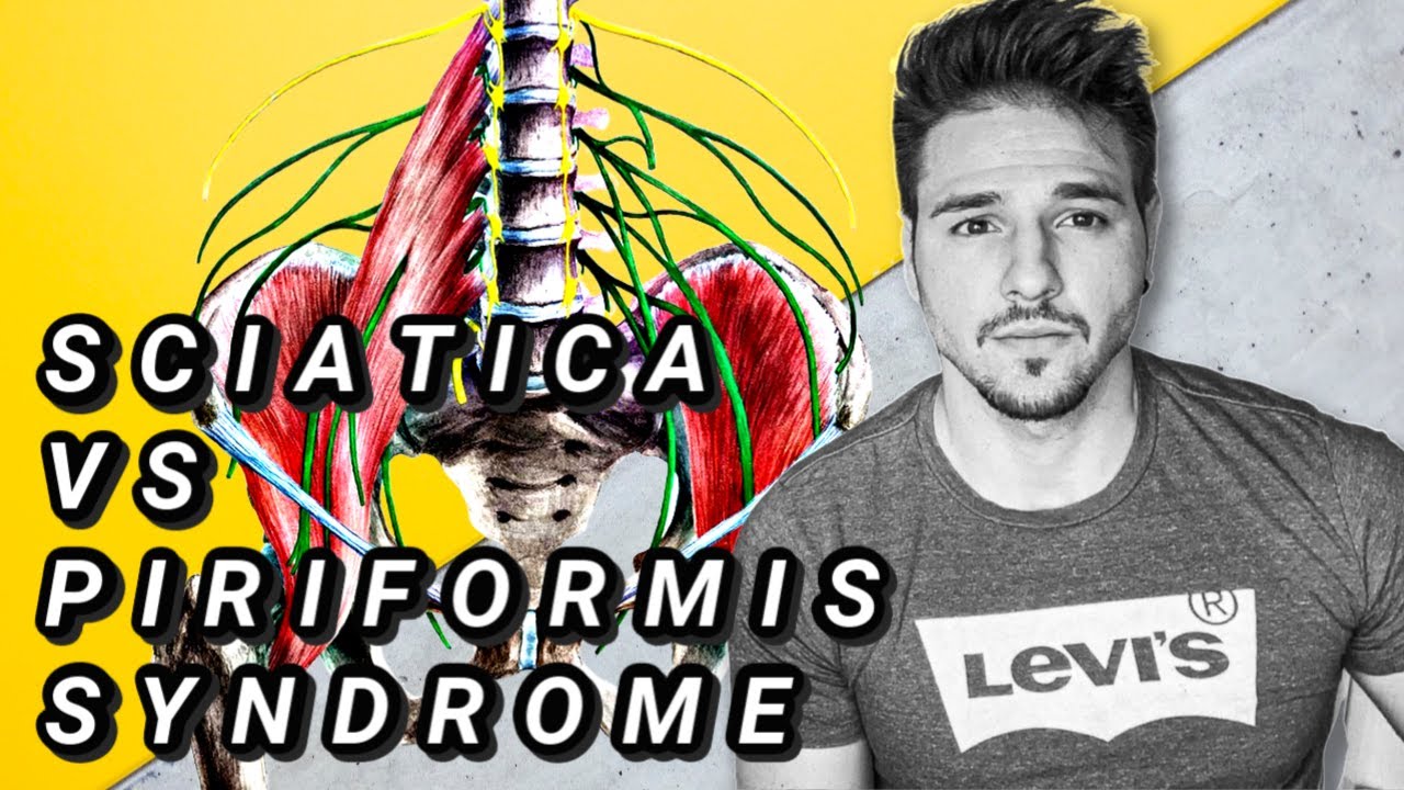 WHAT IS THE DIFFERENCE BETWEEN SCIATICA AND PIRIFORMIS SYNDROME - YouTube