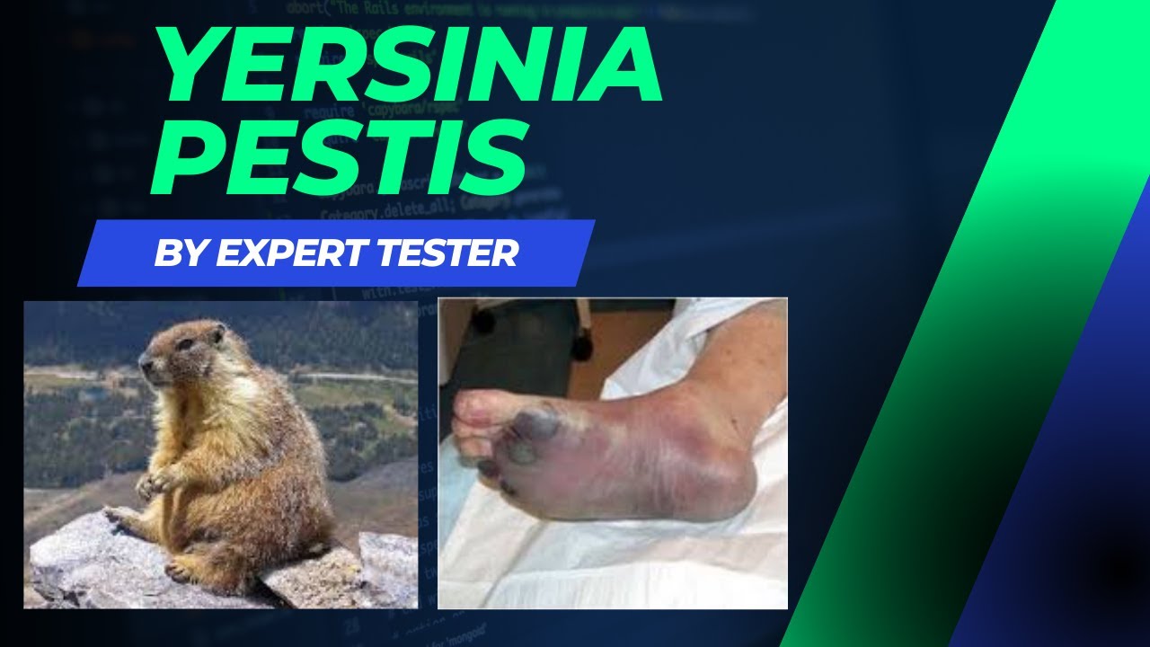 Yersinia pestis | Causes , Symptoms , Diagnosis , Treatment & Pathology ...