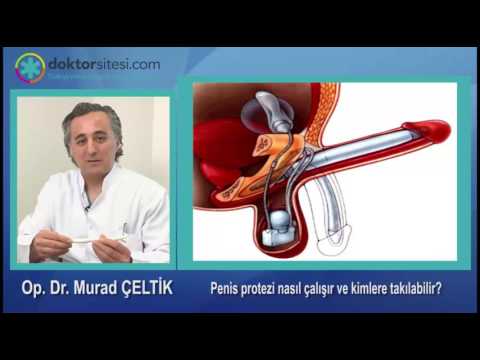 Penis protezi nasıl çalışır ve kimlere takılabilir?