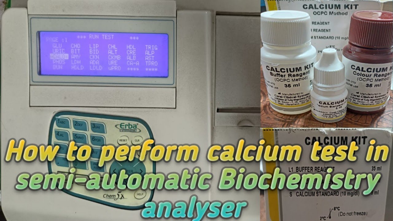 Estimation of serum Calcium in biochemistry analyser || serum calcium ...