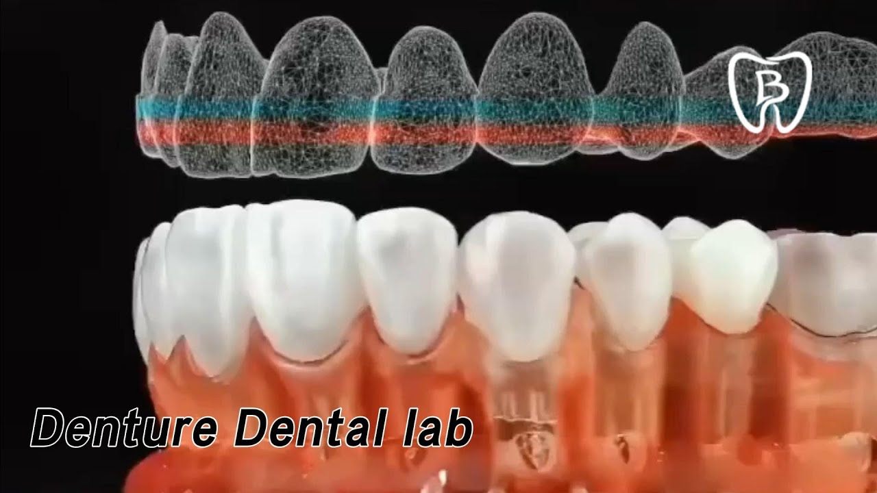 Zirconia Denture Dental lab Teeth High Hardness CAD / CAM Technology ...