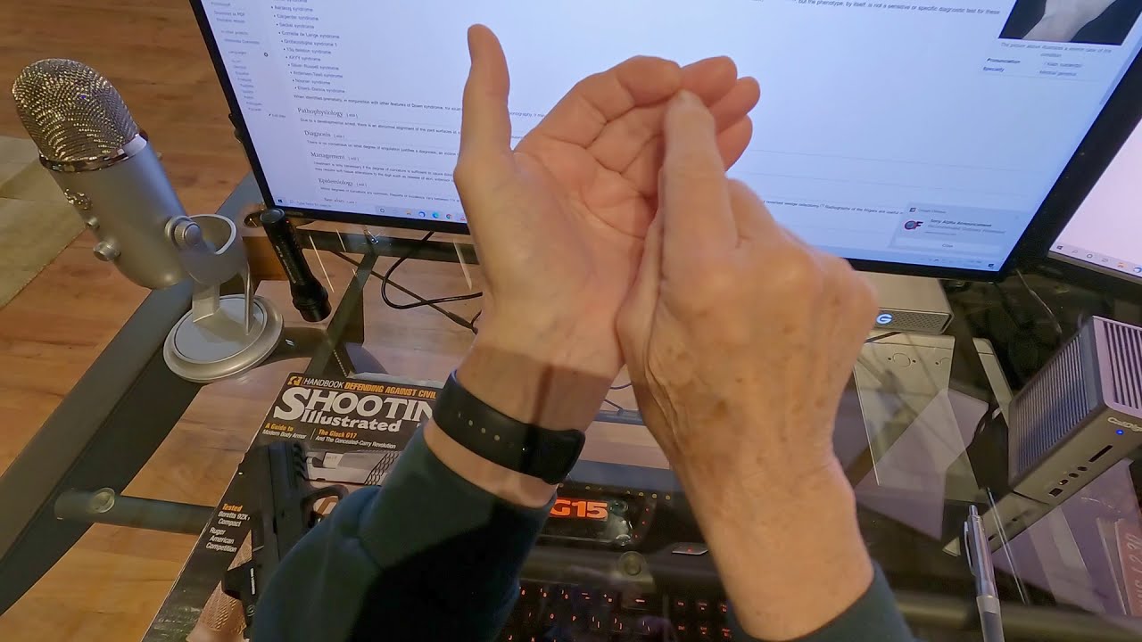 Trigger Bite (sting, slap, pinch) Explained and Solved - YouTube