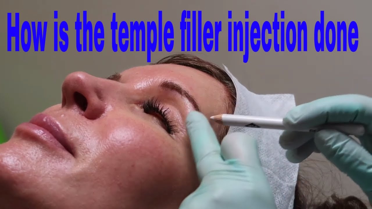 How is the temple filler injection done - YouTube