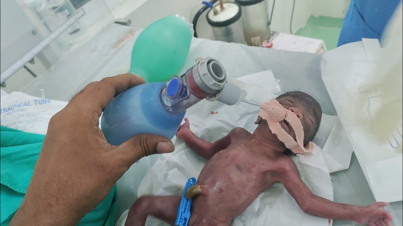 5 months Baby 600 grams Wight 😢😥😢😥 - YouTube