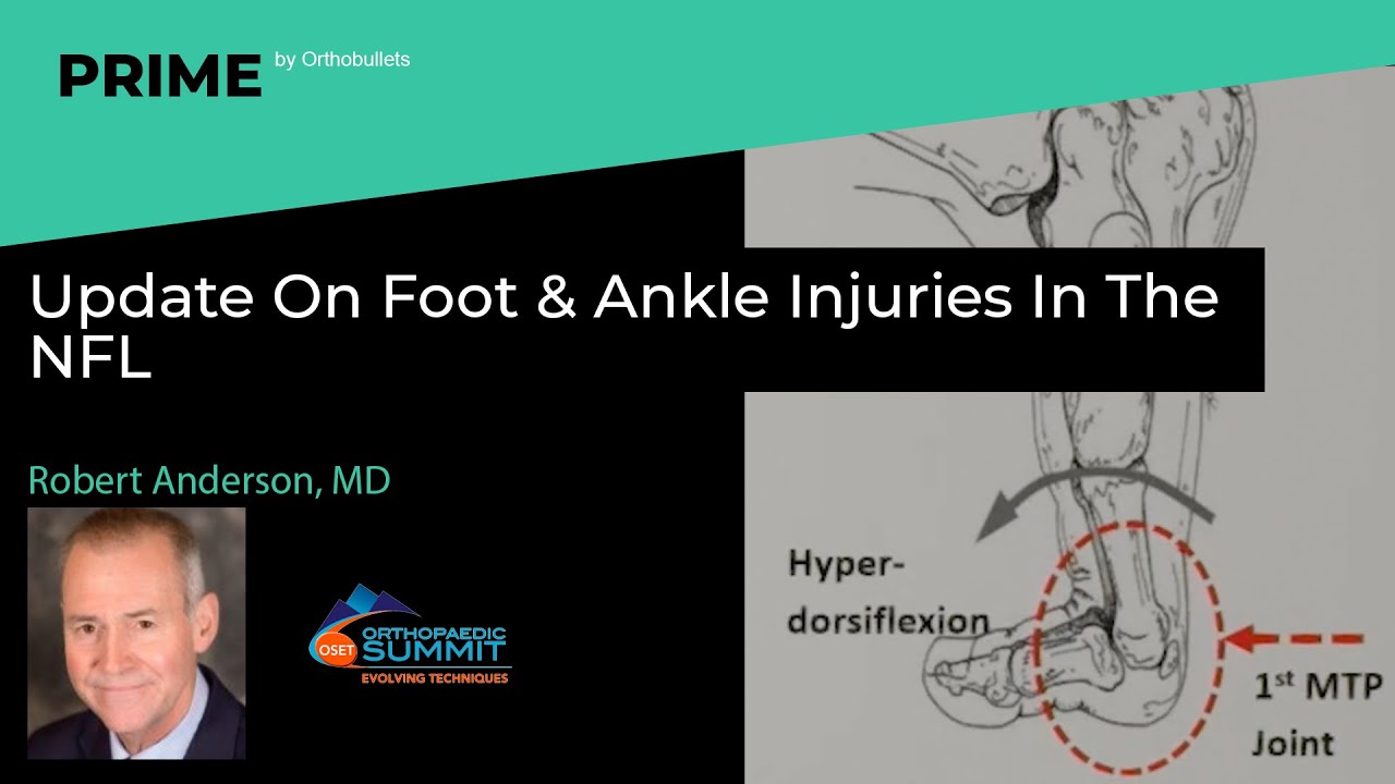 Update On Foot & Ankle Injuries In The NFL - Robert Anderson, MD - YouTube