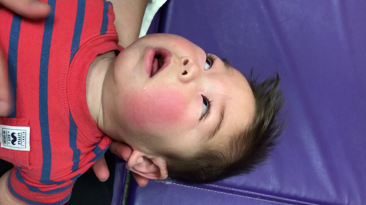 ethan head movement 6/10/2017 - YouTube