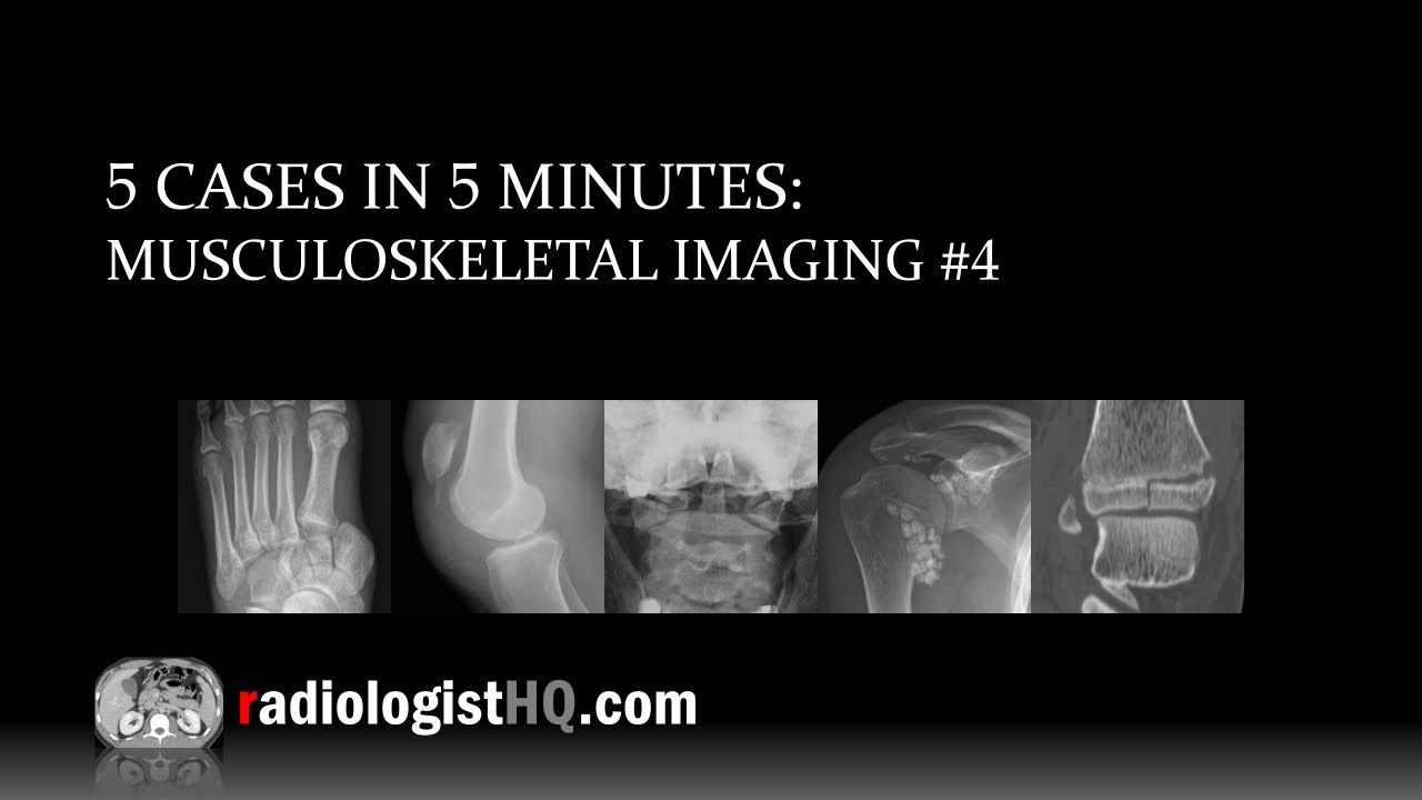 5 Cases in 5 Minutes: Musculoskeletal #4 - YouTube