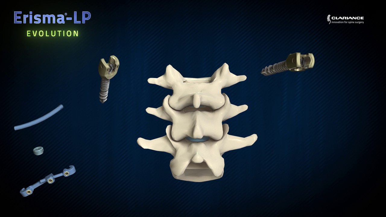 Erisma LP Evolution - YouTube