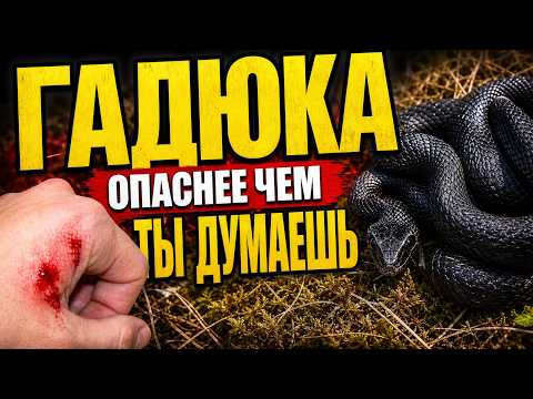 ГАДЮКА укусила — НЕ ДЕЛАЙ ЭТО! Убьёшь себя быстрее яда