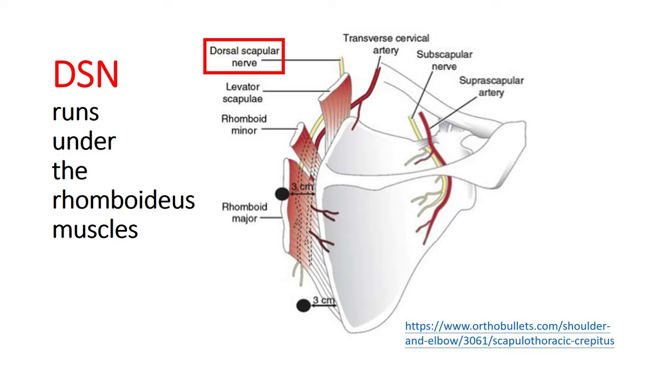 《USG Pain Hydrodissections》 Part 0: Accurate Diagnosis - YouTube