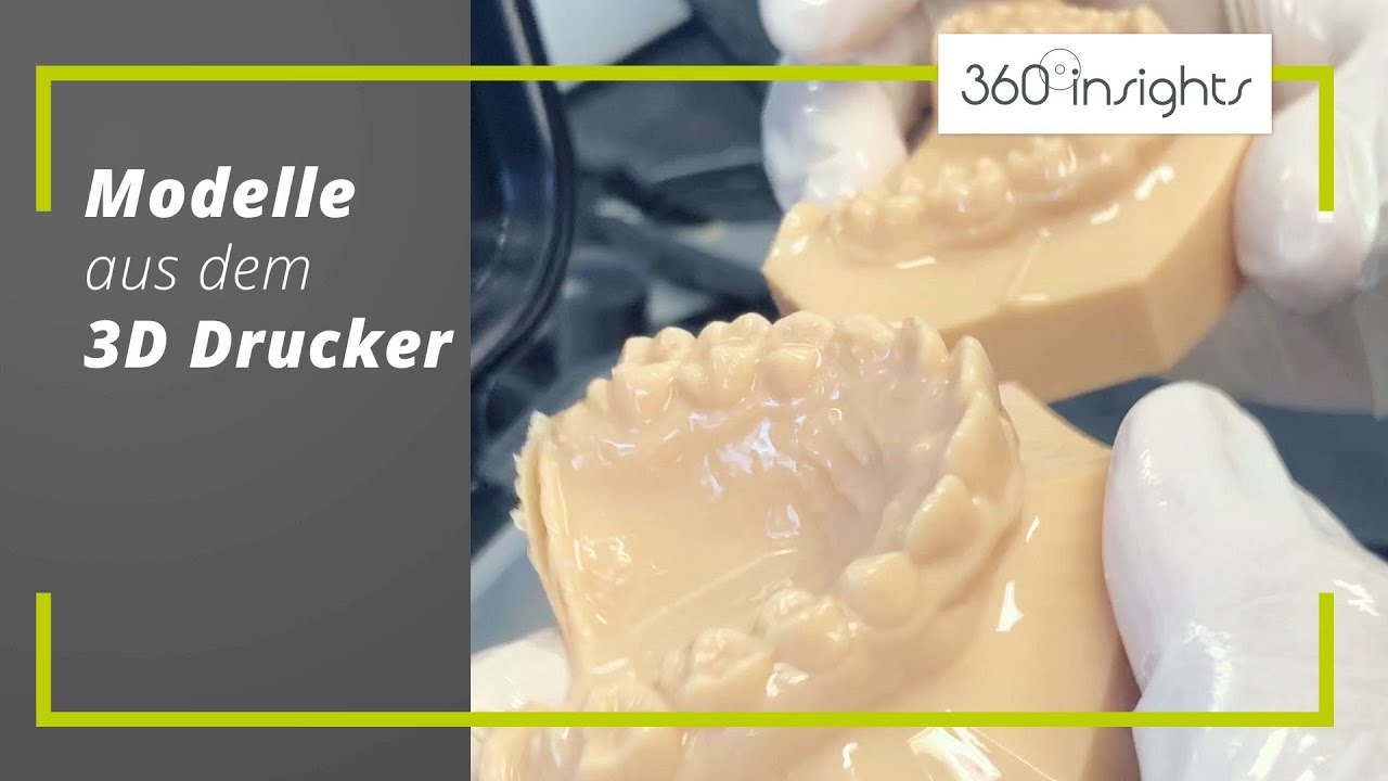 Modelle aus dem 3D-Drucker | 360°zahn insights - YouTube