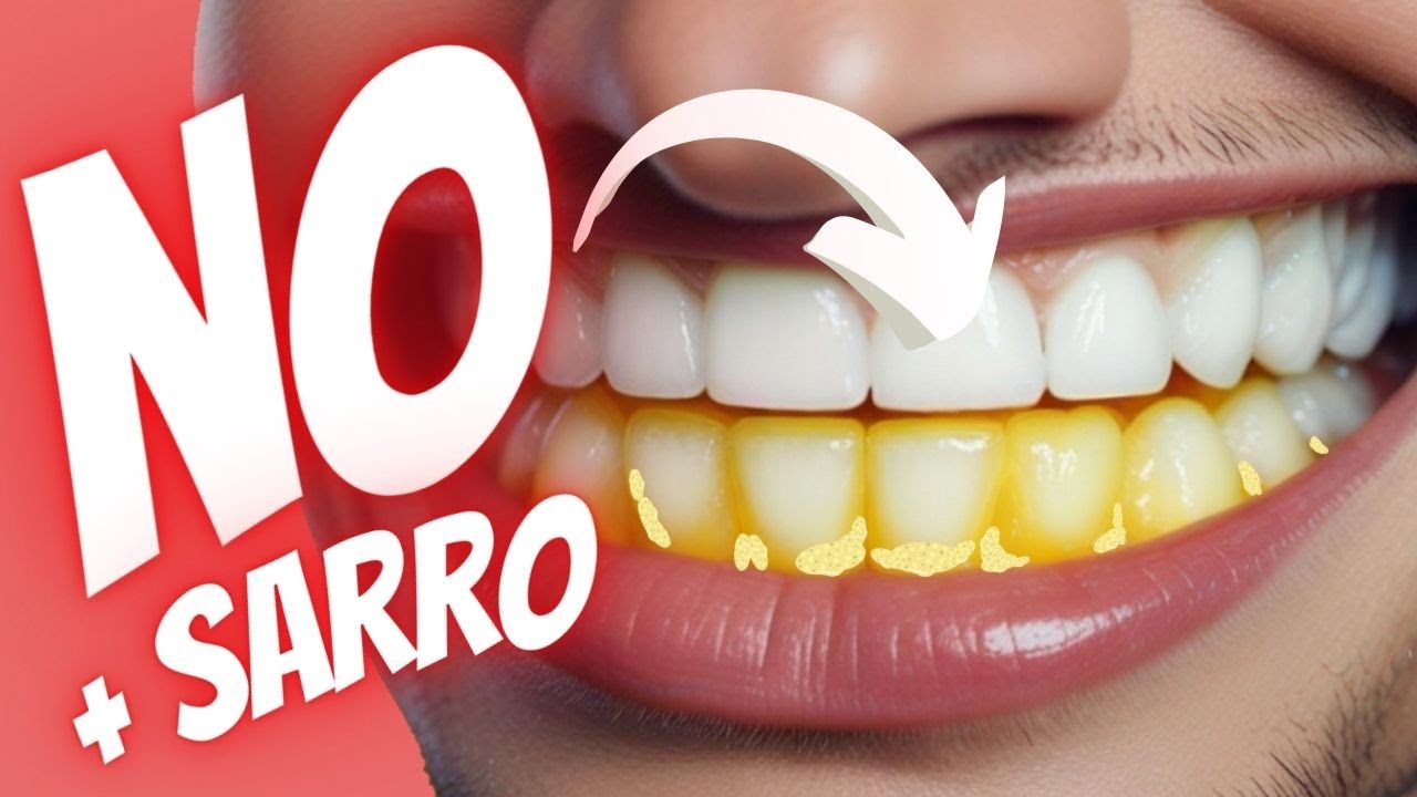 COMO EVITAR la formación DE SARRO en los DIENTES sin estos ALIMENTOS ...