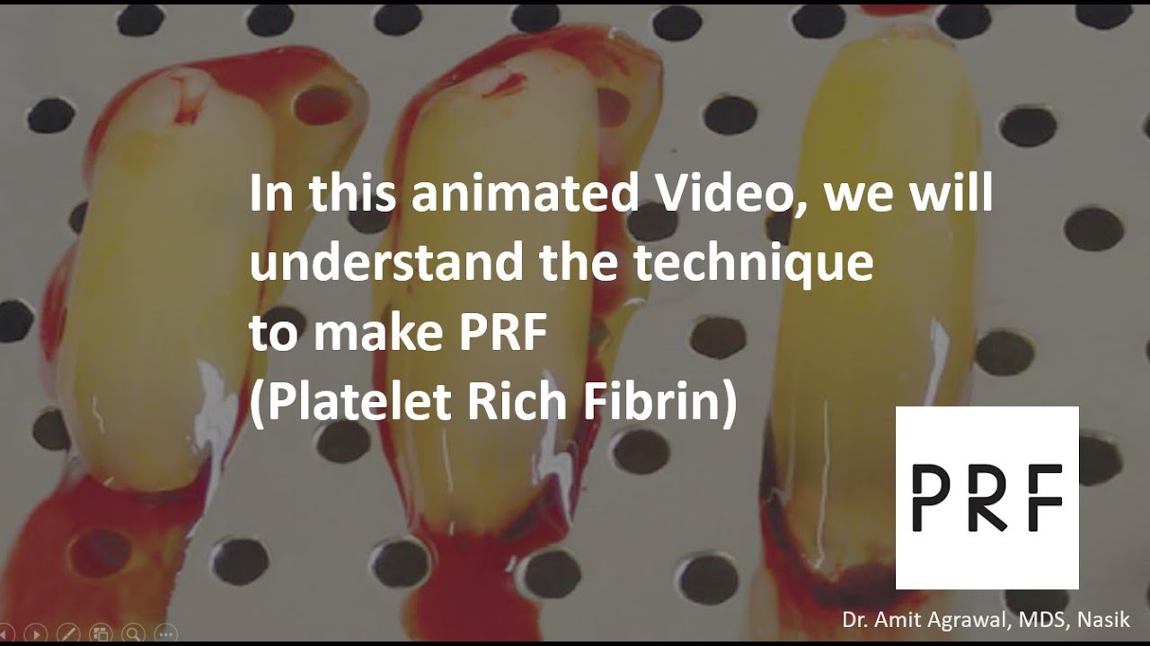 How to make PRF, Animated video - YouTube