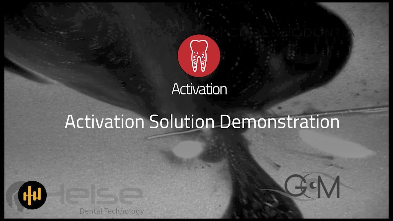 Helse Ultrasonic Endo - Activation - Solution Demonstration - YouTube