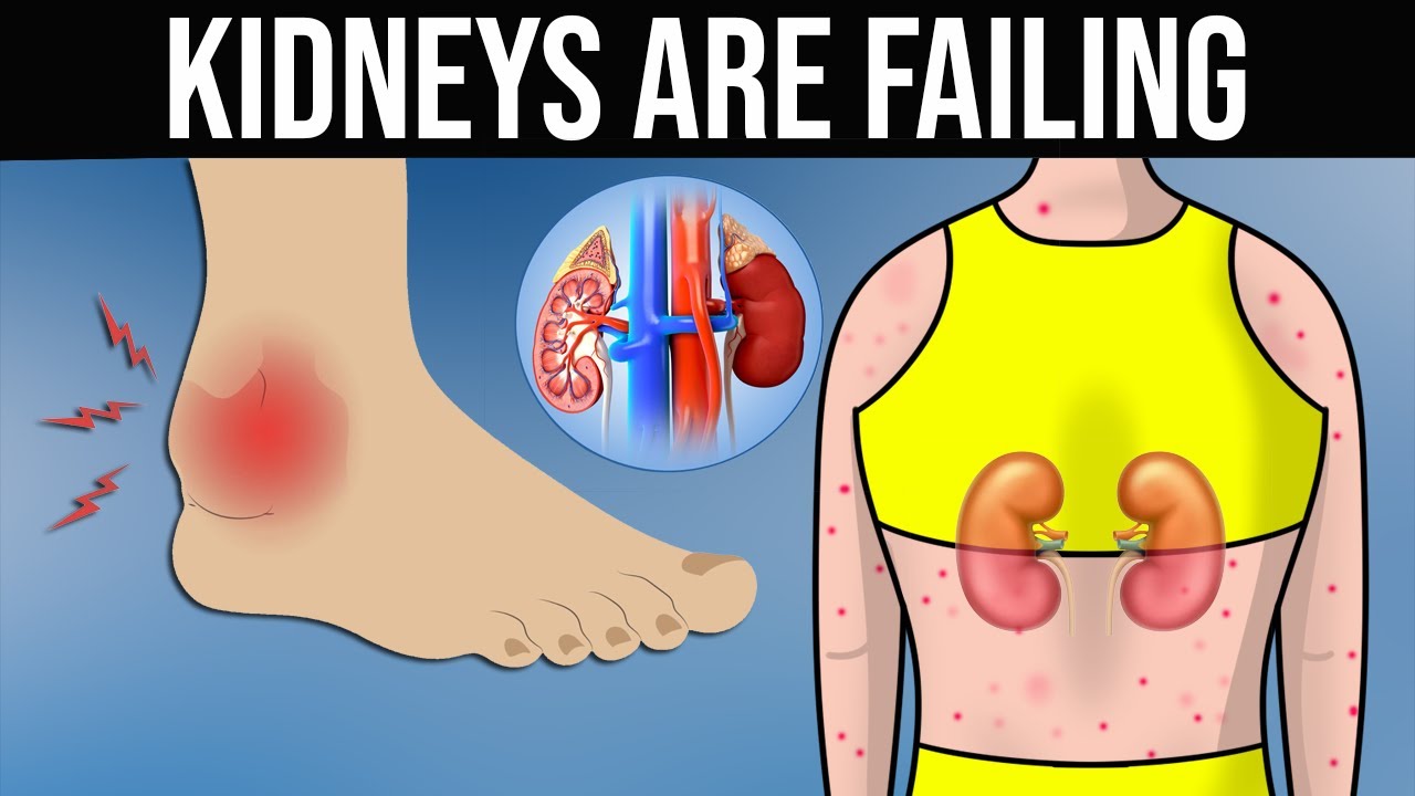KIDNEYS FAILING! PAY ATTENTION TO THESE 8 SIGNS that your KIDNEYS are ...