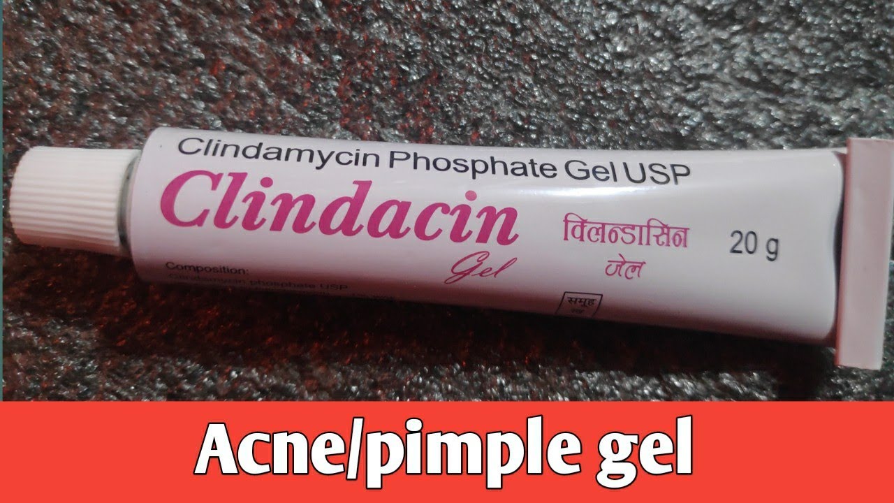 Honest review of Clindamycin acne gel for pimple free skin - YouTube