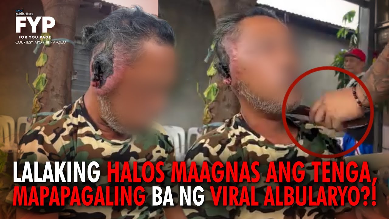 Lalaking halos maagnas ang tenga, mapapagaling ba ng viral albularyo ...