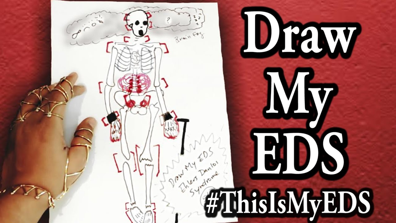 Draw My EDS #ThisIsMyEDS [CC] - YouTube