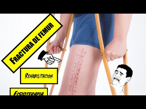 ejercicios en fractura de femur Terapia en casa - YouTube