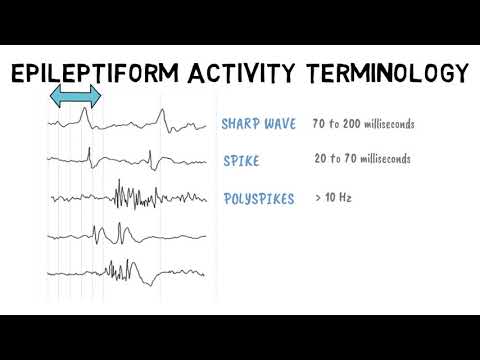 EPILEPTIFORM ACTIVITY TERMINOLOGY - YouTube