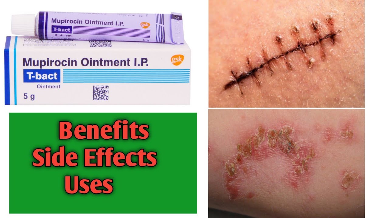 T-Bact Ointment! Mupirocin Ointment! Uses! Side Effects! Benefits # ...