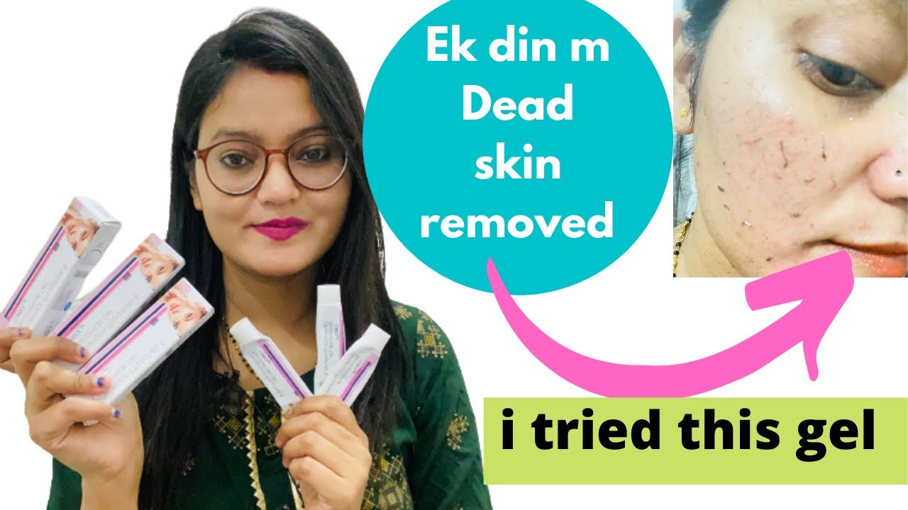 Clinsol gel review || specially acne oily skin - YouTube