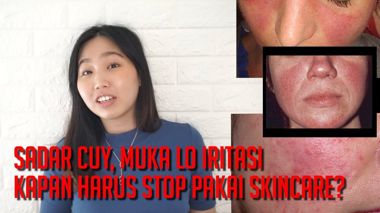 TANDA IRITASI KULIT WAJAH + TIPS MENGATASINYA! | #KeziaVessalius (With ...