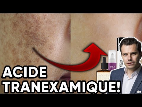 L'HYPERPIGMENTATION FACILE? Et bien plus!