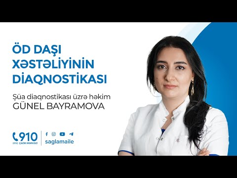 Öd daşı xəstəliyin diaqnostikası | Şüa diaqnostikası üzrə həkim Günel Bayramova