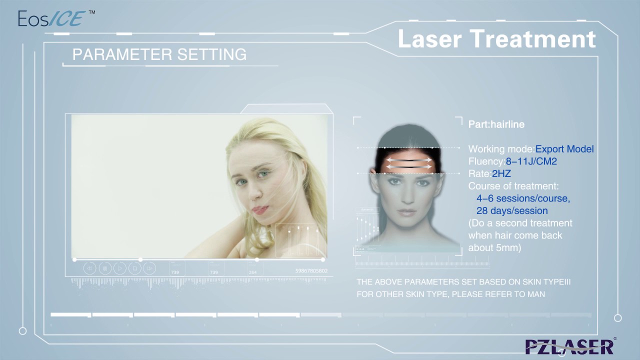 Eos-Ice Hair Removal Laser - YouTube