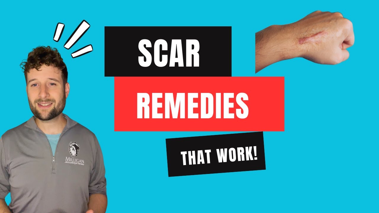 Simple Scar Remedies That Actually Work - YouTube