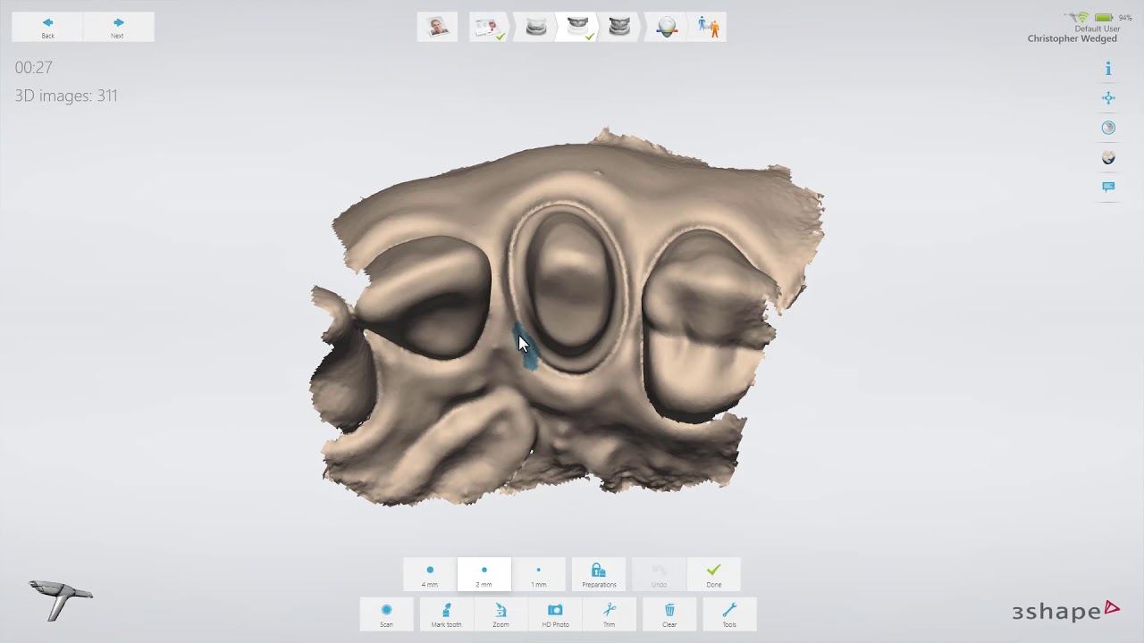 3Shape TRIOS -Trim and Lock Tools ES - YouTube