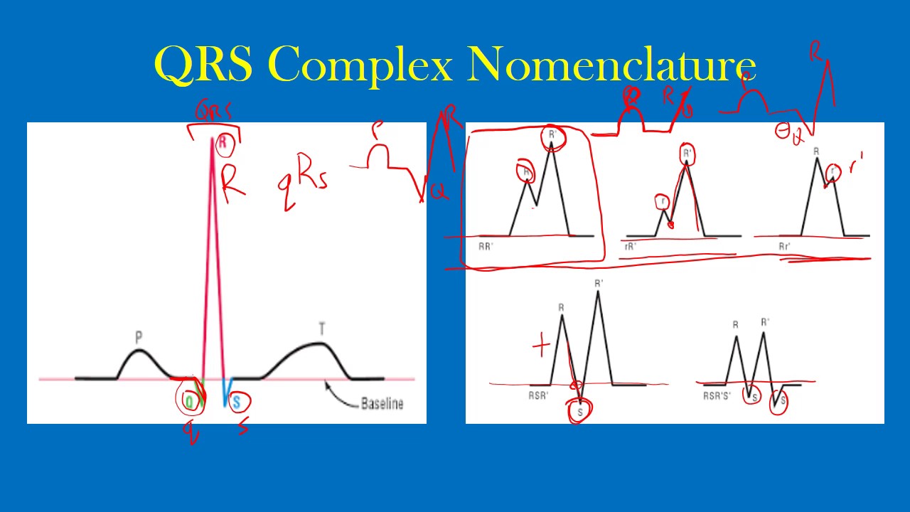EKG 5 0 Basic Componets of the EKG Complex - YouTube