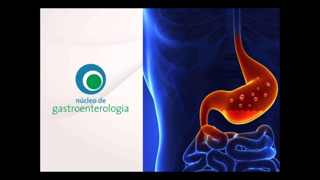 #EspecialistaSamaritano - Refluxo Esofágico - YouTube