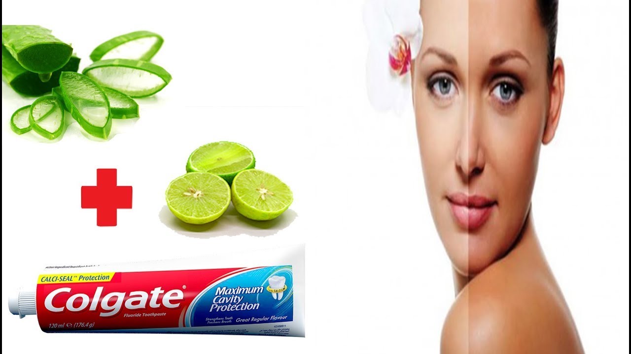 Skin Whitening Home Remedies Lemon, Colgate Toothpaste And Aloe Vera ...