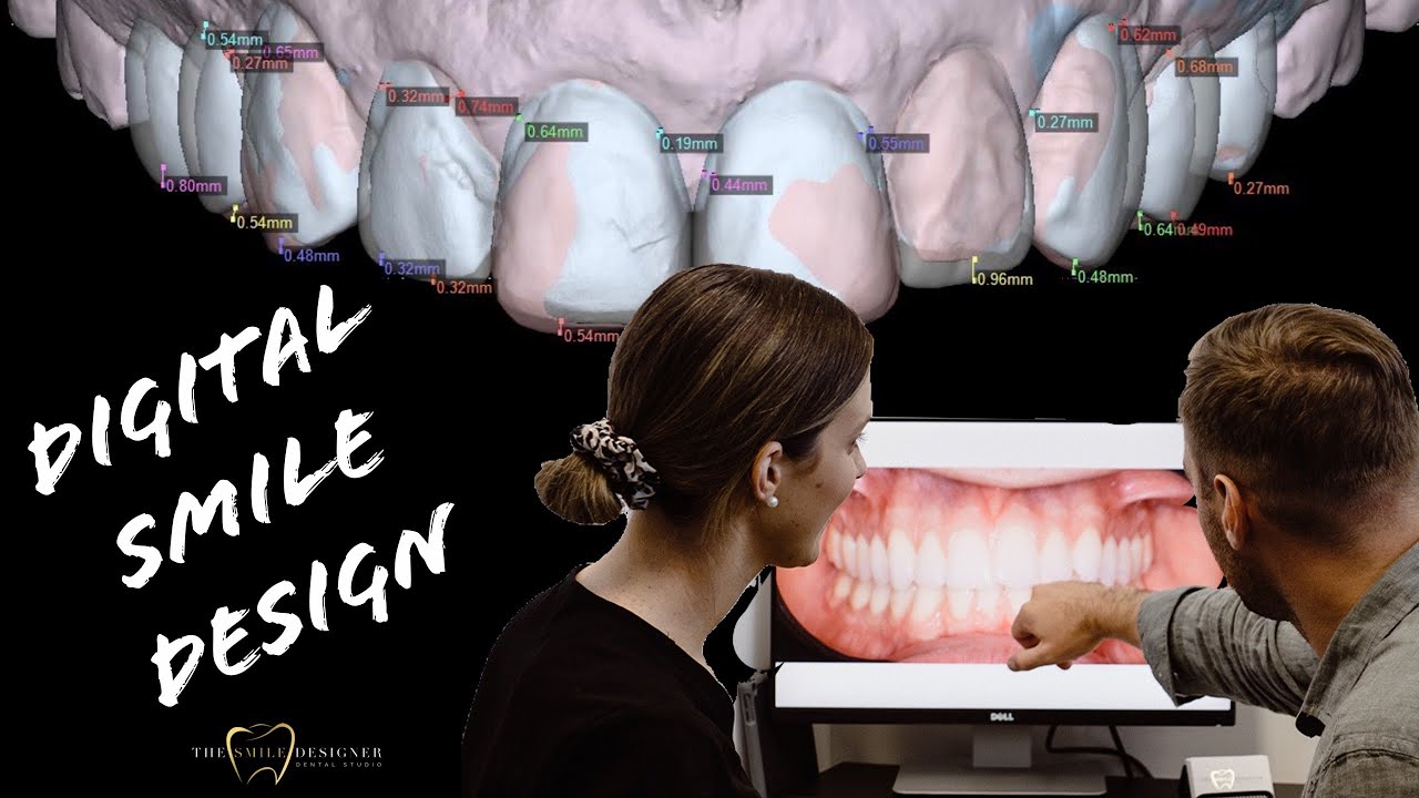 Digital Smile Design - YouTube
