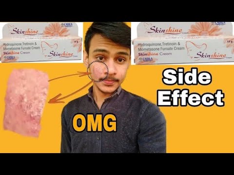 Skin Shine Cream - Uses, Side- effects,Reviews, Composition... || skin ...