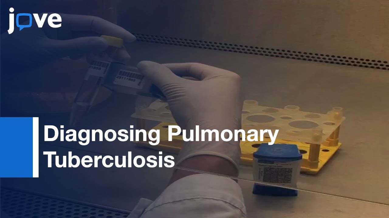 Diagnosing Pulmonary Tuberculosis with the Xpert MTB/RIF Test - YouTube