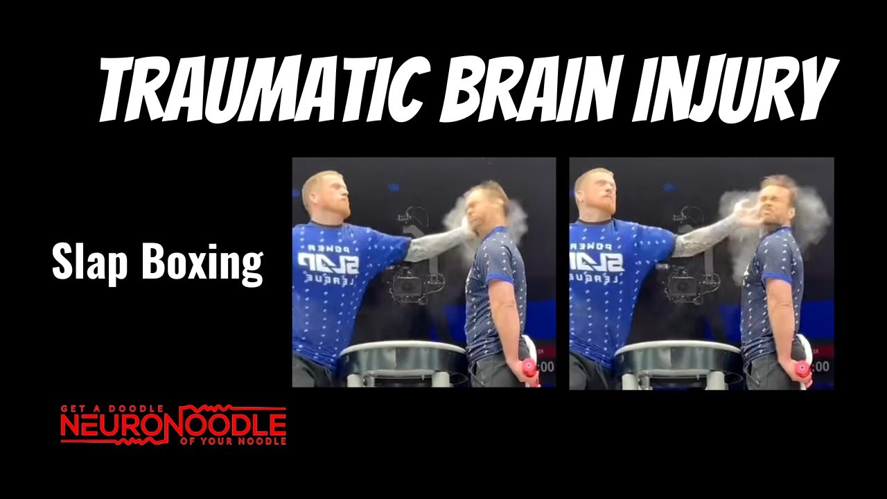 TBI And The Power Slap League: Trauma that can occur from being slapped ...