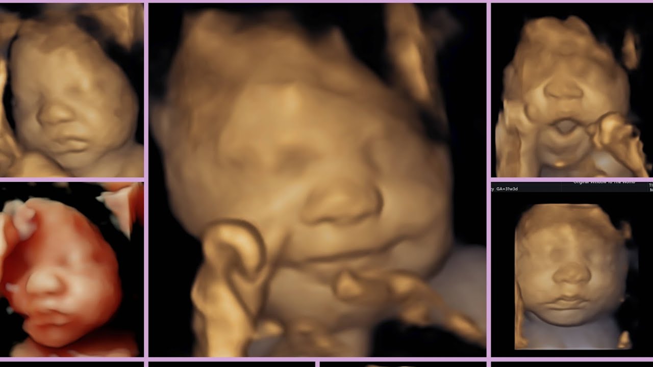 31 WEEKS 4d & hdlive - YouTube