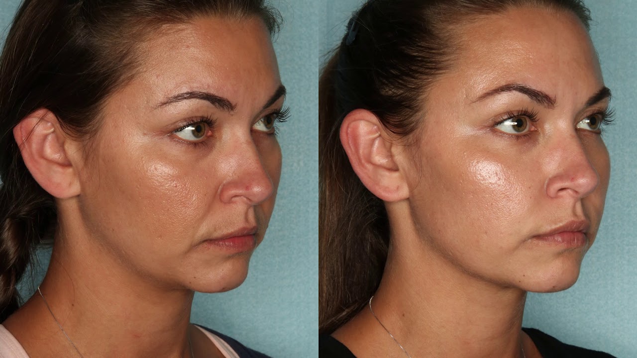 Aesthetics In Plastic Surgery By Kiran Gill Md Youtube