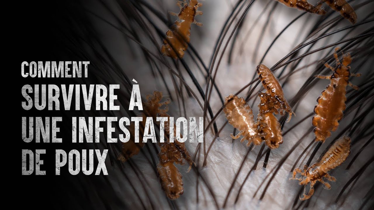 Comment survivre à une infestation de poux - YouTube