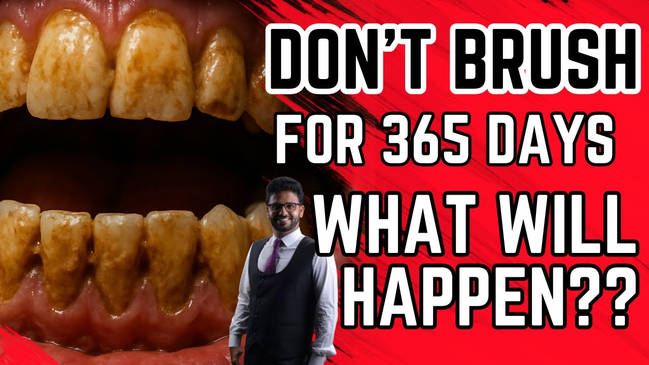 What Happens If You Don’t Brush Your Teeth for a Year?! (You’ll Be ...