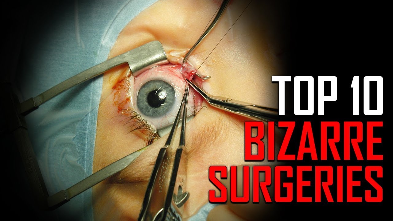 Top 10 Bizarre Surgical Operations - YouTube