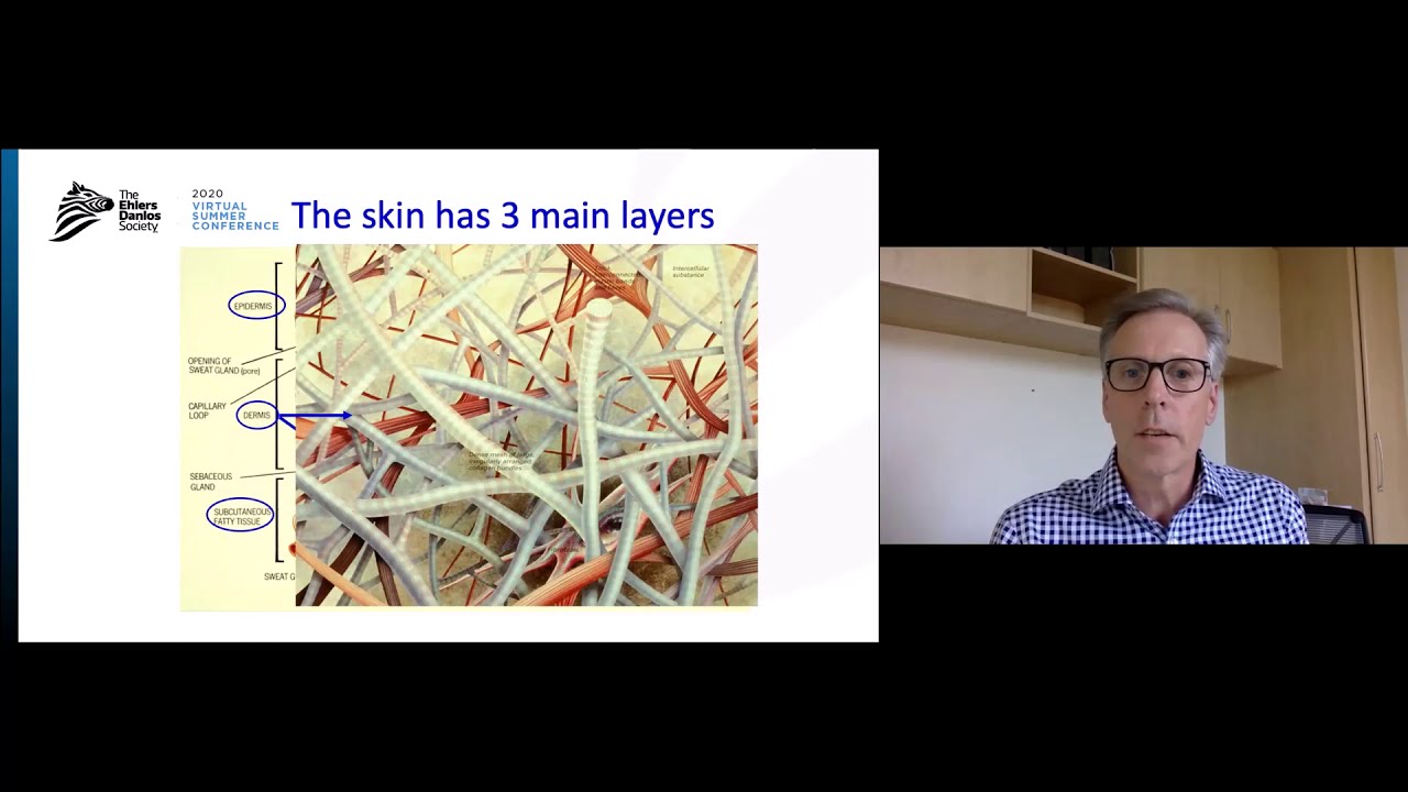 Managing Skin Complications - Dr. Nigel Burrows | English (EN) - YouTube