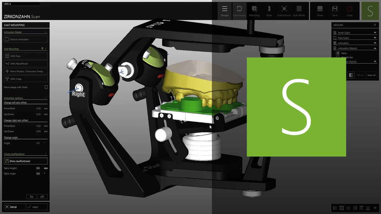 Zirkonzahn.Scan, the software that makes the difference! | Zirkonzahn ...