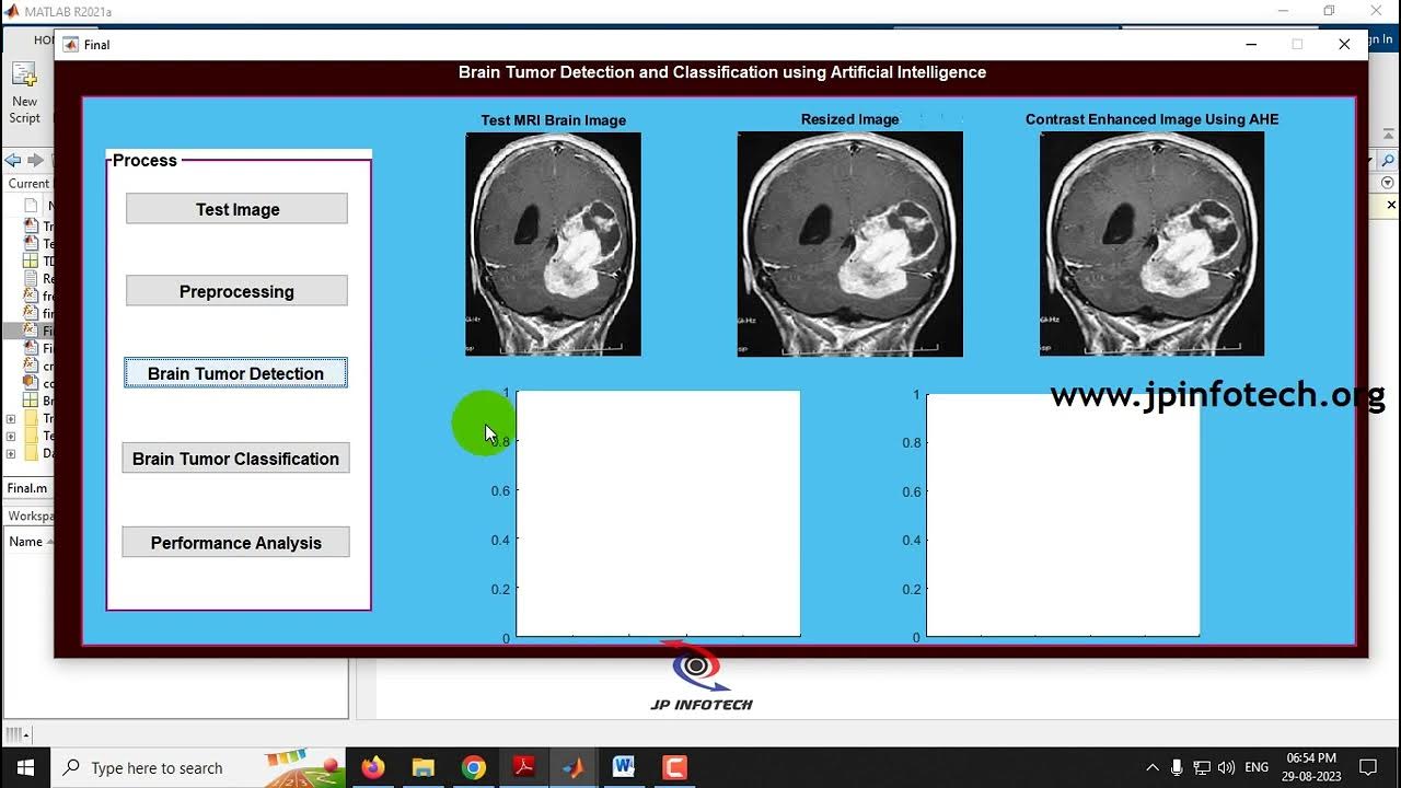 Brain Tumor Detection and Classification Using Artificial Intelligence ...