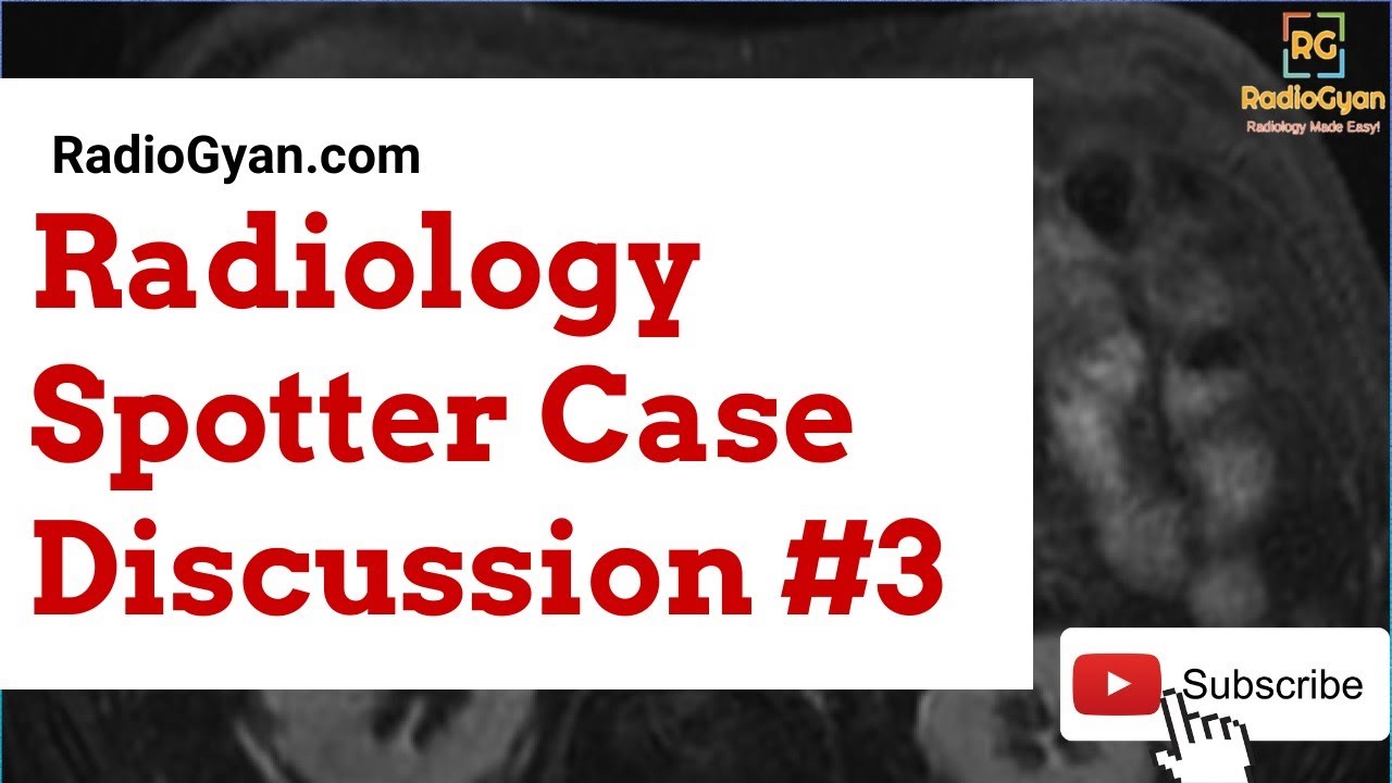 Radiology Cases - Spotters Set 3 : Quiz and Discussion (LIVE) - YouTube