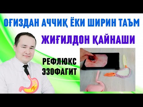 ОҒИЗГА АЧЧИҚ ТАЪМ КЕЛИШИ, ЖИҒИЛДОН ҚАЙНАШИ, РЕФЛЮКС ЭЗОФАГИТ,  САБАБИ ВА ДАВОЛАШ ТАКТИКАСИ
